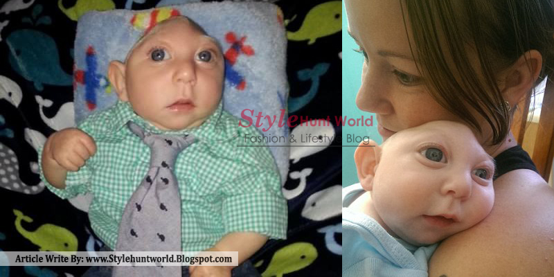 OMG - Baby Born Without Head - Miracle Baby Born Without A Scull ...