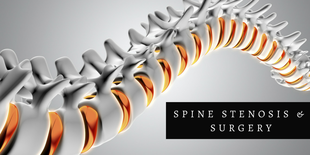 Spinal Stenosis and Surgery
