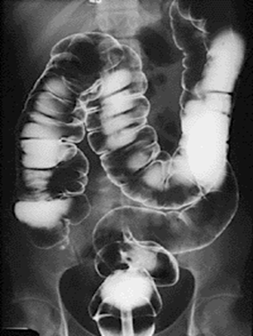 Radioblog Radiologia