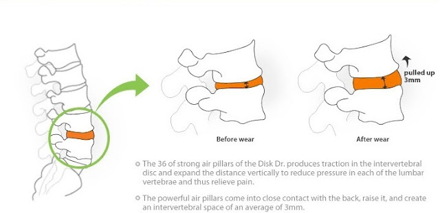 Lumbar Air traction brace: Lumbar Air Traction Brace WG30 MAX