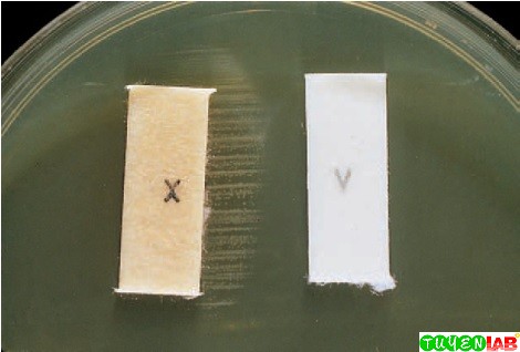[Microbiology] Atlas of Haemophilus and Other Fastidious Gram-Negative ...