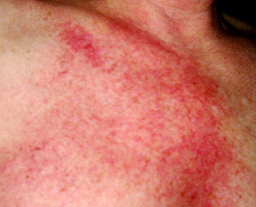 Patti's Progress: April 2014