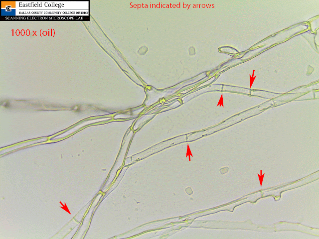 Scanning Electron Microscope Blog: A Few More Fungi