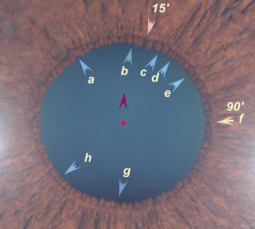 Modern & Multidimensional Iridology: Multidimensional Iridology ...