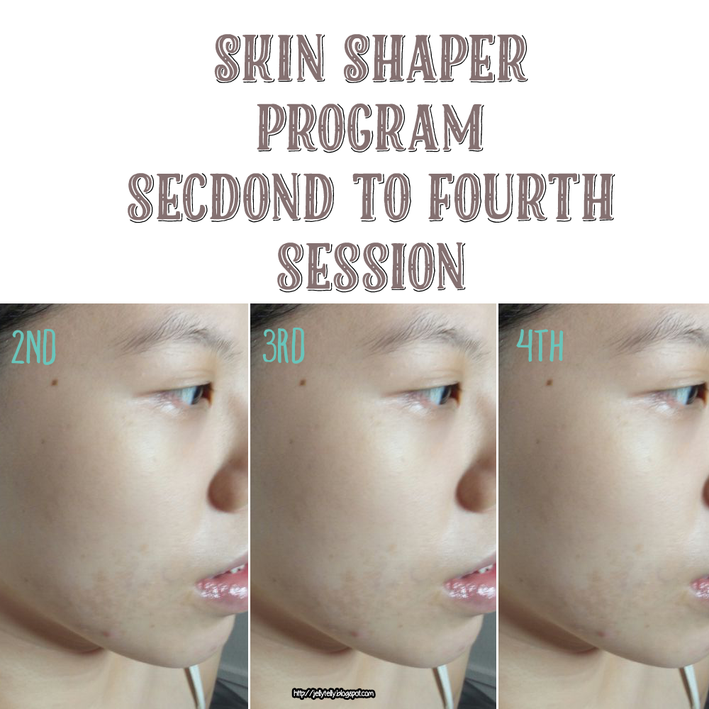 Puzzle of Life: [Sponsored] Skin Shape Club - Skin Shaper Plus Program