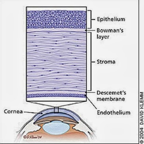 Korpus Alienum Kornea, Benda Asing Di Kornea Part 2 Medical Articles