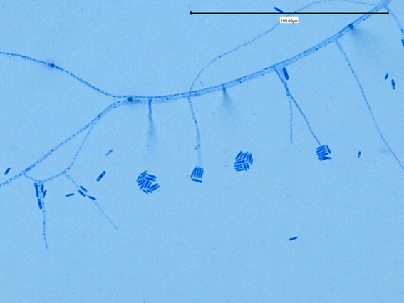 Fun With Microbiology (What's Buggin' You?): Sarocladium kiliense
