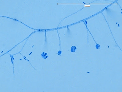 Fun With Microbiology (What's Buggin' You?): Sarocladium kiliense
