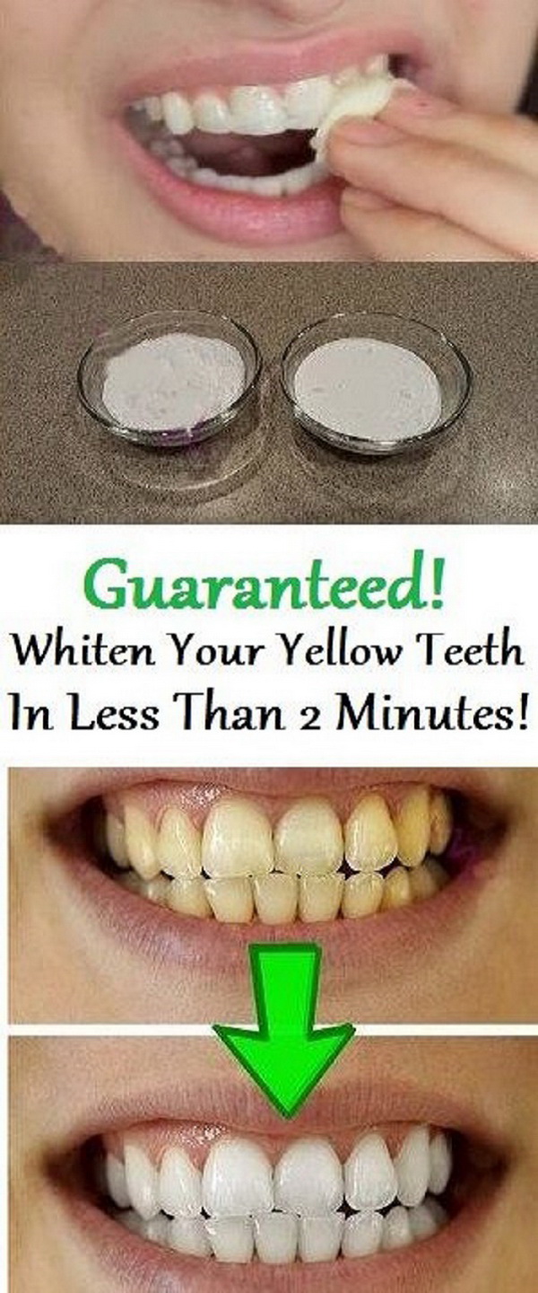 How To Whiten Teeth Naturally At Home