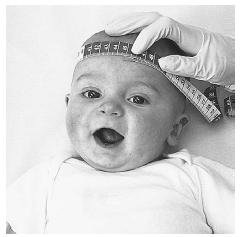 Health Care: HEAD EXAMINATION OF INFANT OR CHILD