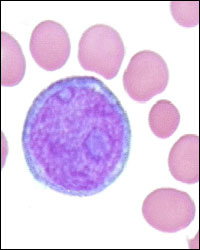 Hematología 2015
