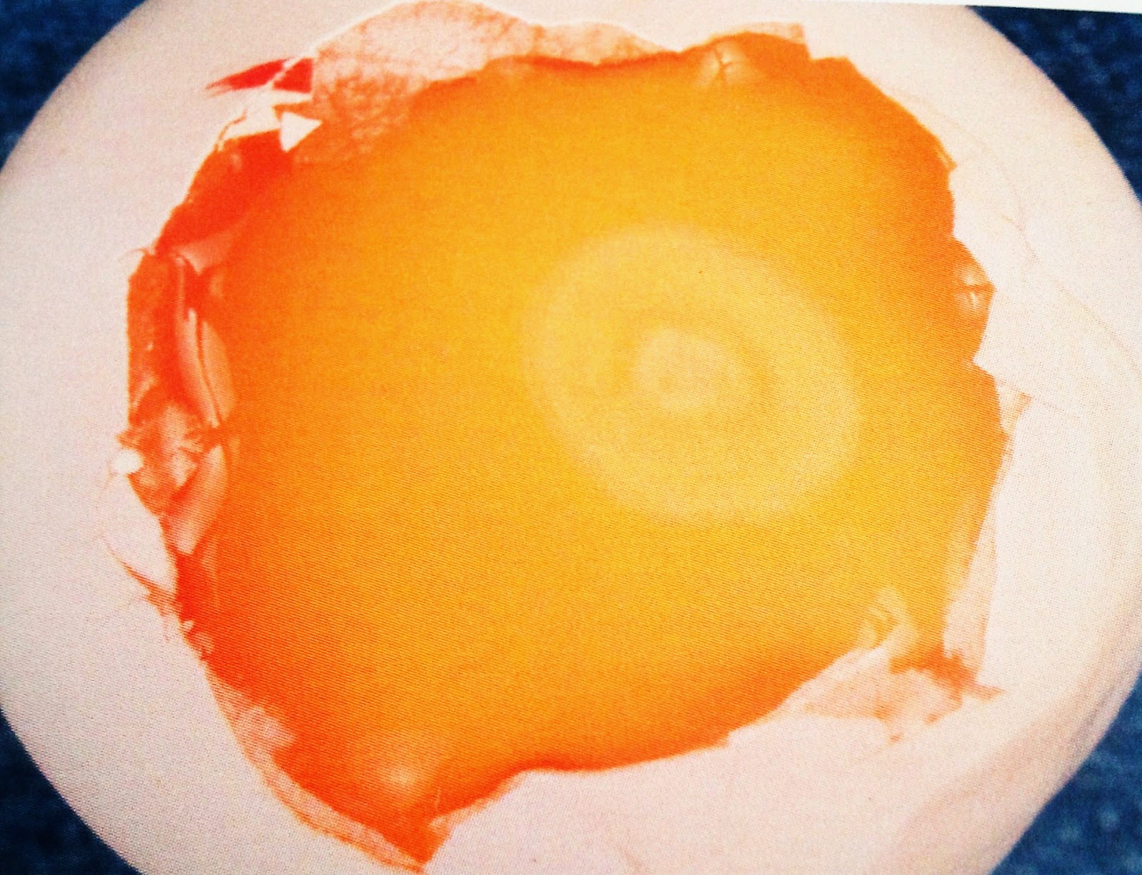 Embryo after one day in the setter.