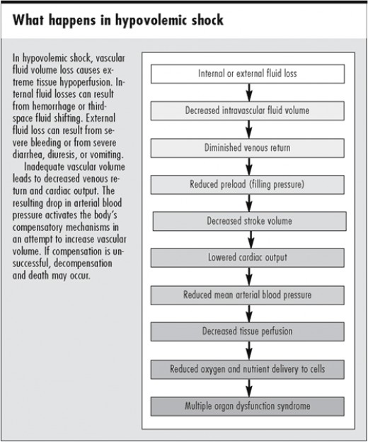 Shock - Definition, Types, Morphology, Stages and Clinical Course