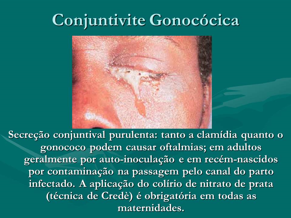 BIOLOGIA COM A PROFESSORA EDILENE: IST - INFECÇÕES SEXUALMENTE ...