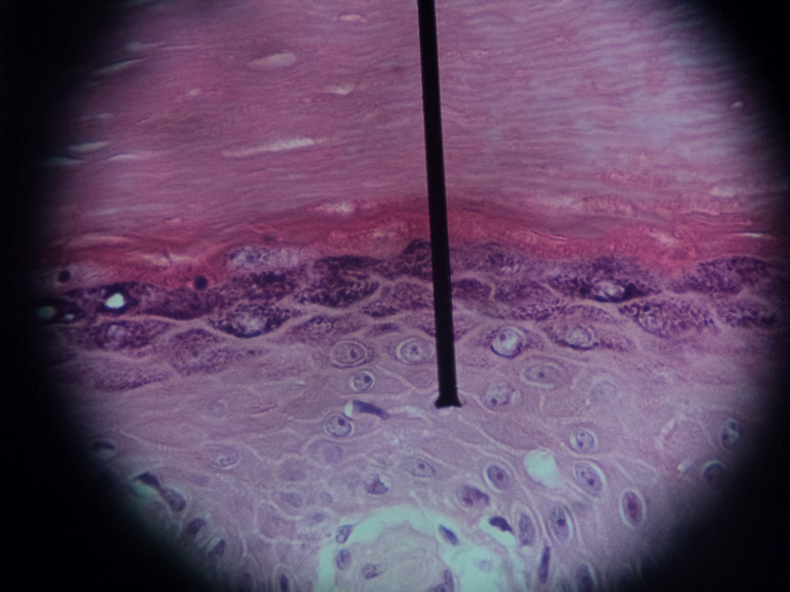 MEDICINA USMP: FOTOS DE HISTOLOGIA II - PULPEJO DE DEDO