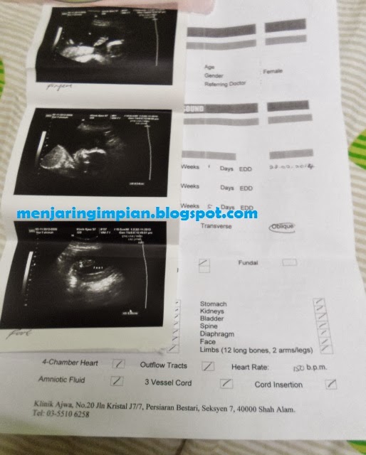 MENJARING IMPIAN: Hasil Detail Scan Dekat Klinik Ajwa