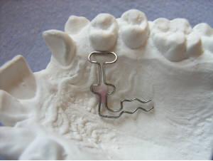 Dentistry lectures for MFDS/MJDF/NBDE/ORE: A Note on Active Components ...