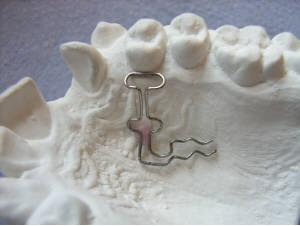 Dentistry lectures for MFDS/MJDF/NBDE/ORE: A Note on Active Components ...