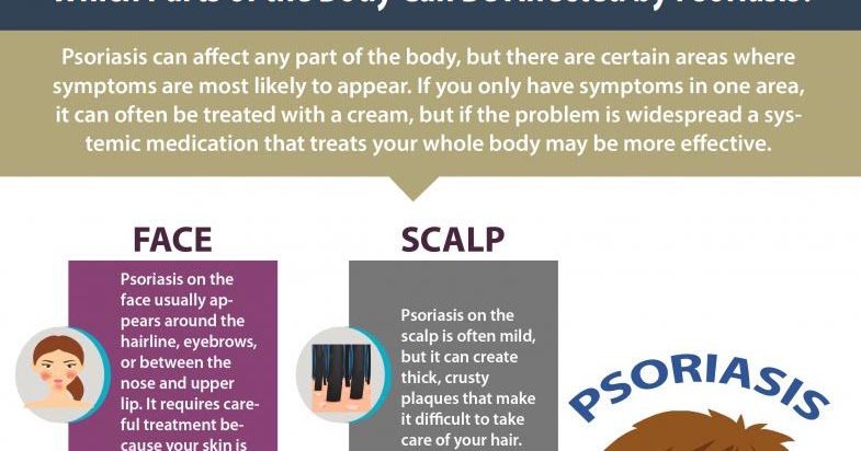 Psoriasis Help 4 Friends: The difference between psoriasis and eczema