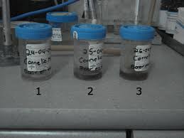 Blog del Laboratorio clinico : Muestra de Esputo