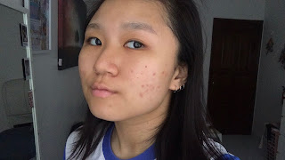 first facial experience @ One Doc Medical - Nourish to Flourish.