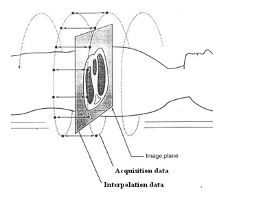 บันทึกของลูกช้างรังสี: หลักการทำงานของ Spiral CT.
