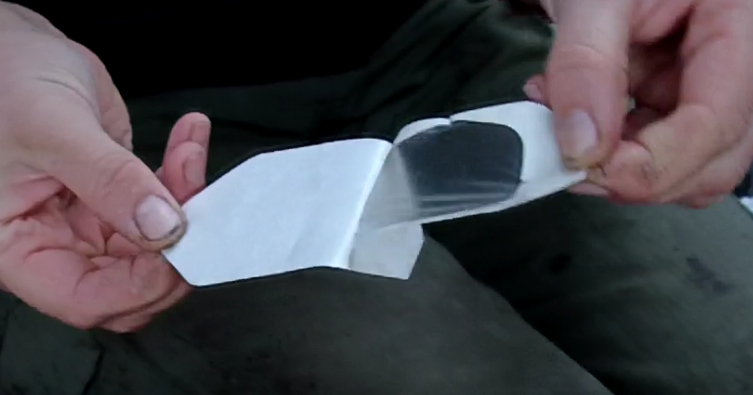 Remote Medicine Ireland: How to use Steri Strips