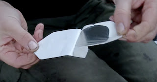 Remote Medicine Ireland: How to use Steri Strips