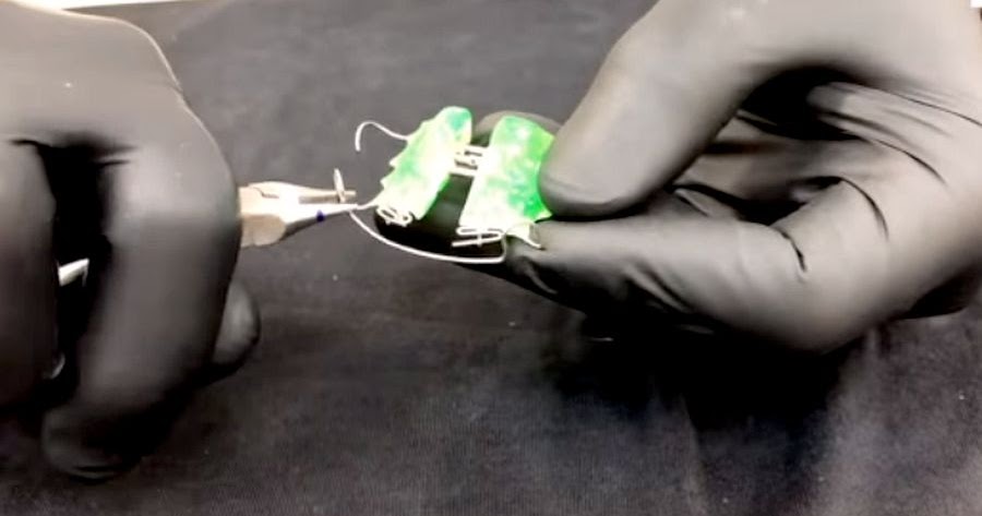 ORTODONTIA: Dica Ativação do Arco de Hawley - Prof. Marden Bastos ...