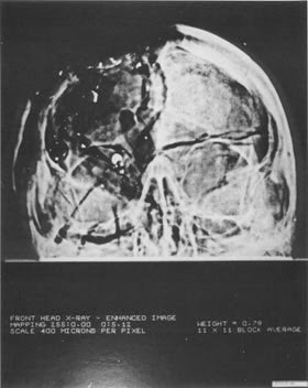 warnepiece.com: The John F. Kennedy Assassination - my perspective 50 ...