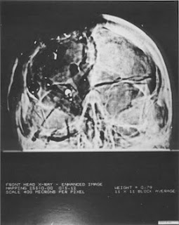 warnepiece.com: The John F. Kennedy Assassination - my perspective 50 ...