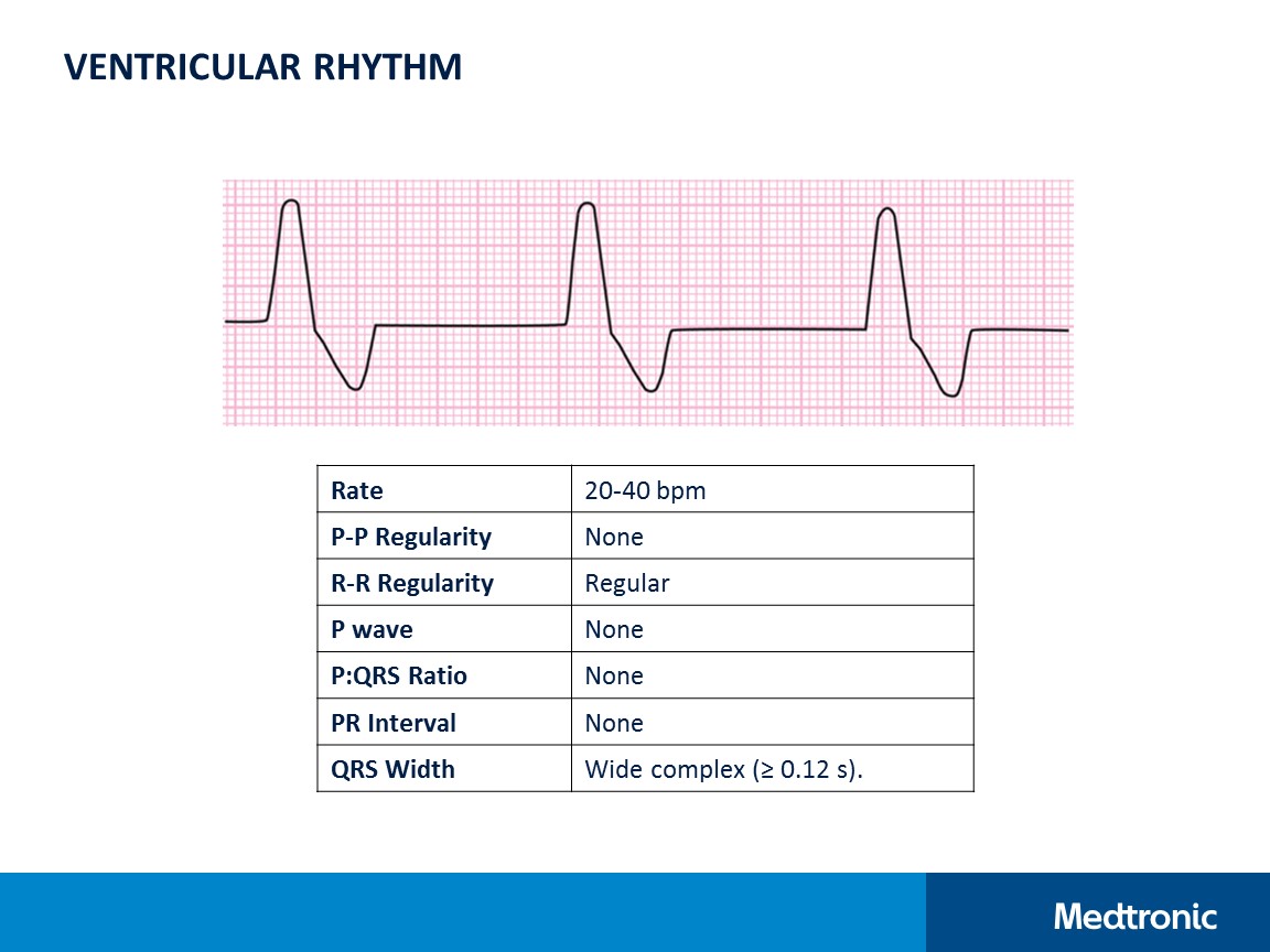CVT Mohd Farid: Heart Rhythm Interpretation Part I-Medtronic Academy