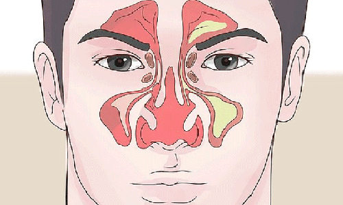 Ho un idea non ci vuole Einstein : Come liberare il naso chiuso in 1 ...