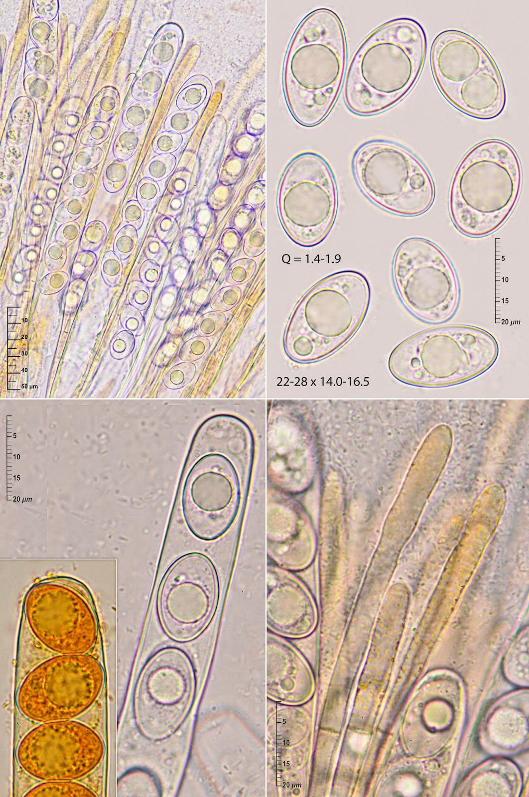 Octospora excipulata (Clem.) Benkert • CEMAS hongos briofíticos ...
