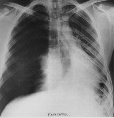 imaging of rontgen: BELAJAR BACA FOTO THORAX