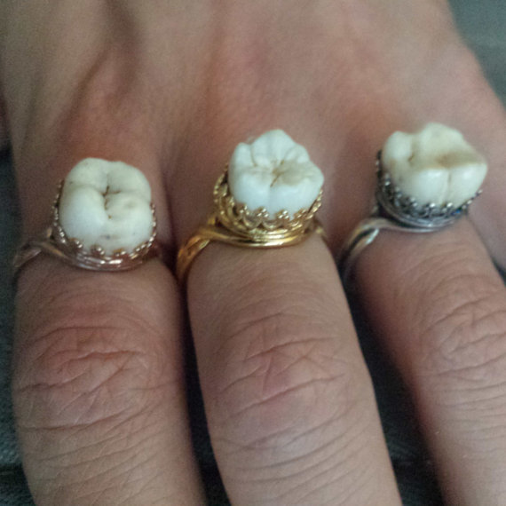Etsy Finds: Rings | DELICATE TEETH