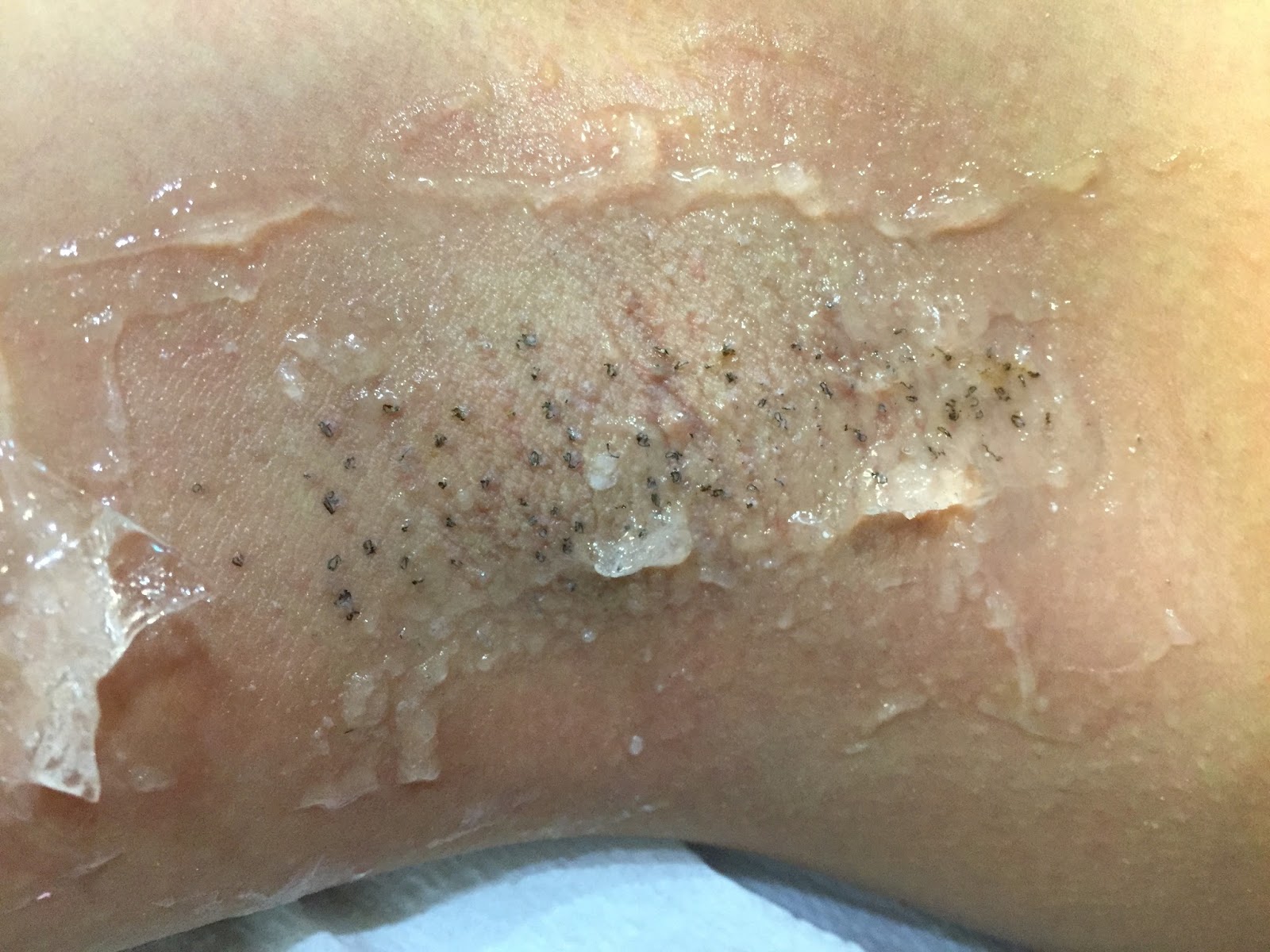 C3 Clinical Corrective Care: Hair Removal