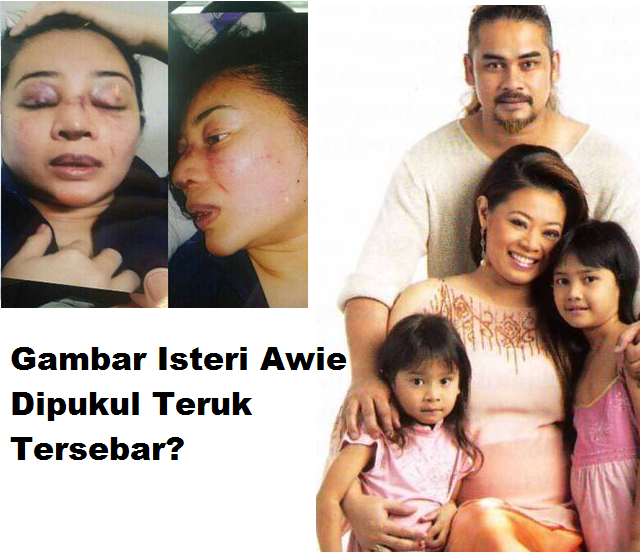 GAMBAR ISTERI AWIE DIPUKUL MULA TERSEBAR DI MEDIA ?? | Silang Jari