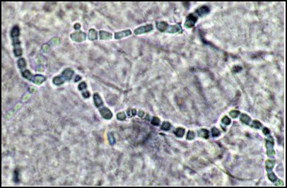 Dermatophyte : trichophyton | Medik Bloglist