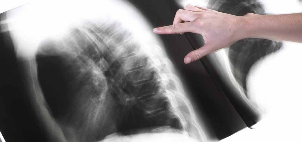 SCOPE: X-Ray: the invisible files