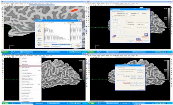 Neuroimaging Made Easy : Brainvoyager QX tips and tricks 1; Some ...