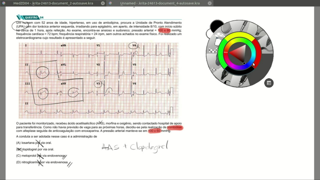 frequencia respiratoria - wood scribd braxin