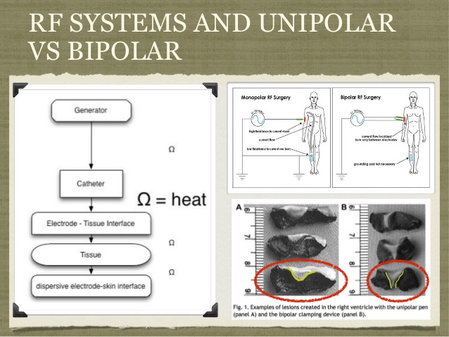 Dr Han Naung @ Henry Han : Electrophysiology and Heart Rhythm ...