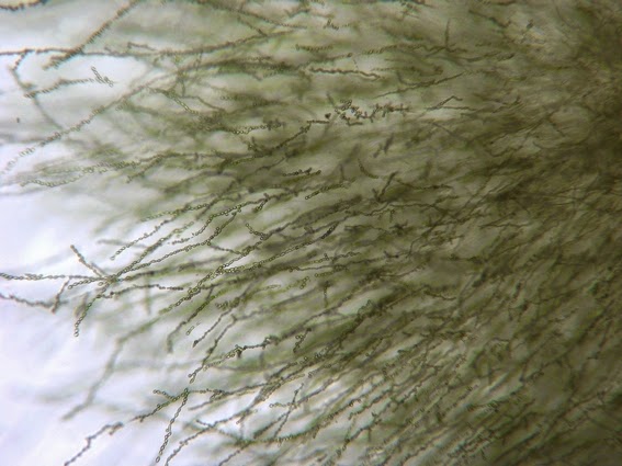 Fun With Microbiology (What's Buggin' You?): Trichosporon species