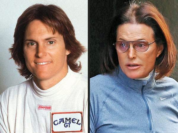 The Kardashians Step Father, Bruce Jenner: Transitioning To A Woman ...