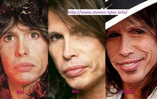 Steven Tyler: Steven Tyler Facelift Before and After