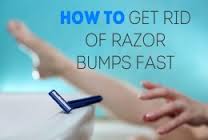 Best quotes for you: How To Get Rid Of Razor Burn Fast On Armpits, Legs ...
