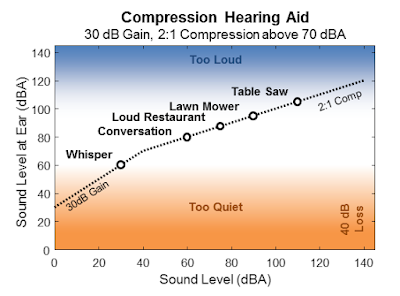 Open Audio: The Need for Dynamic Range Compression