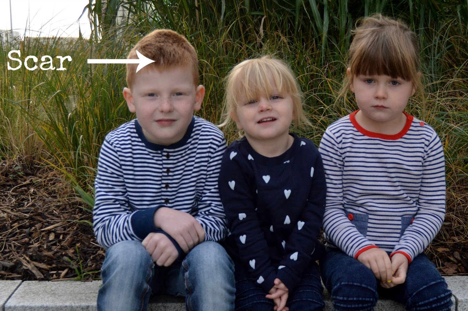 Germolene Scar Stories - We're going on an adventure