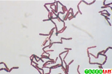 [Microbiology] Atlas of Aerobic Gram-Positive Bacilli | Free Medical Atlas